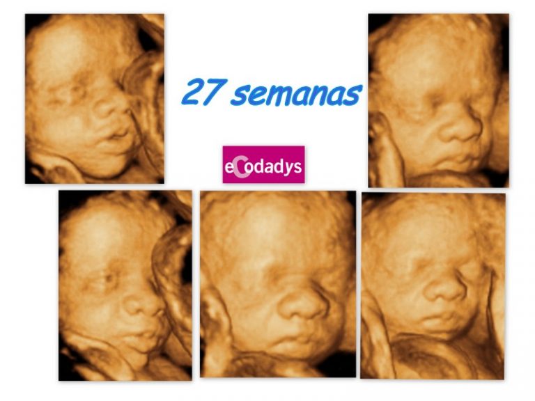 ¡No esperes! Con las ecografías 4D puedes ver la carita de tu bebé en ...